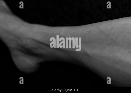Protruding veins in the human body, human body forms, medicine, human ...