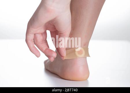 Woman sticks a medical plaster to the plantar wart of the leg to remove ...
