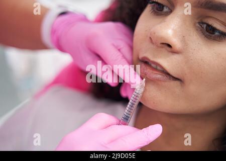 Lip augmentation procedure performed on the face of young patient Stock ...