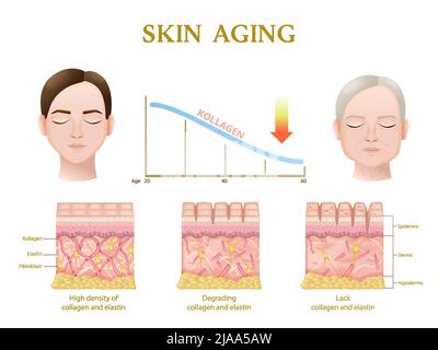 Collagen structure. The structure of the skin. Infographics. Vector ...