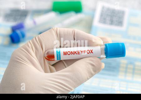 Monkeypox PCR test tube in doctors hand, medical worker in medical mask ...