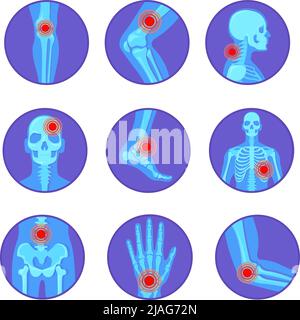 Rheumatology medicine, joint diseases treatment and x-ray banner. Human ...