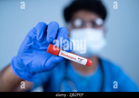 Monkeypox virus infection blood sample test with pills, tablets blood ...