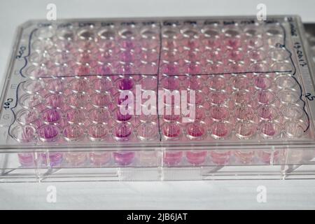 96well plate filled with cell medium and cells lying on laboratory ...