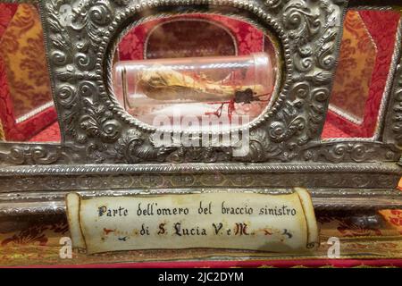 The humerus - the upper arm bone - of the left arm of Santa Lucia, a ...