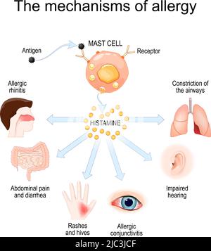 Histamine. Mast cells and Immune response on Allergic reaction ...