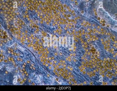 Symbiotic algae (zooxanthellae) from Aiptasia sp., probably belonging ...