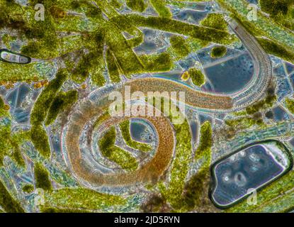 A microscopic roundworm collected from a marine aquarium Stock Photo ...