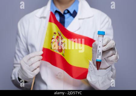 Monkeypox virus. Spain flag background. Epidemic concept. Virus ...