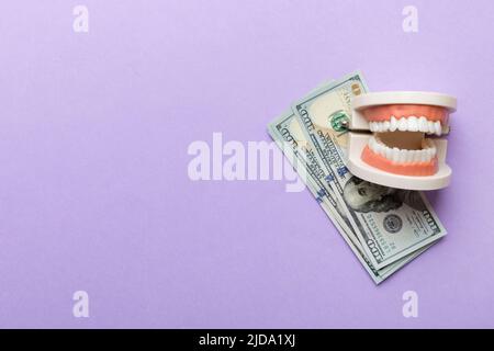 Model of oral cavity with teeth and dollar banknotes on light blue ...