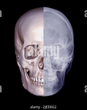 Skull 3D from CT Scan of facial bone 3D rendering showng human skull ...