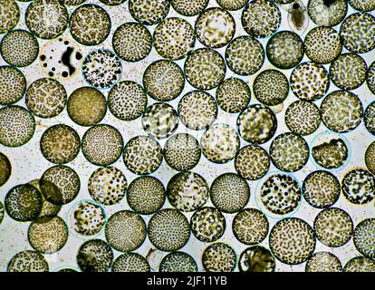 Large, single-celled algae cells of the genus Halosphaera (probably H ...