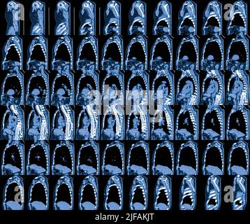 Magnetic Resonance Image (MRI) of chest organs Stock Photo - Alamy