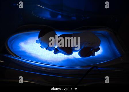 Newborn baby lying on LED phototherapy light bed to treat jaundice ...
