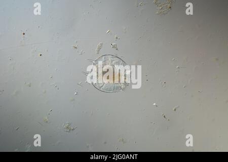 Rotifer foraging in the stream 100x Stock Photo - Alamy