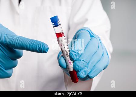 hand in medical gloves is handling a blood probe with Covid indicator ...