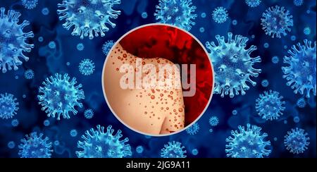 Monkeypox infection and virus, illustration Stock Photo - Alamy