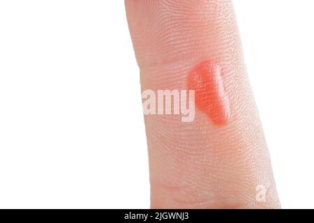 a human hand injured after a work accident, band-aid, band-aid to wrap ...