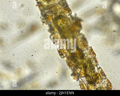 Filamentous algae under microscopic view Stock Photo - Alamy
