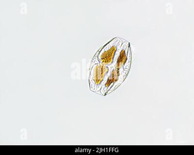 Amphora sp. algae under microscopic view, Diatoms, phytoplankton ...