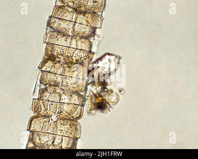 Freshwater aquatic zooplankton and algae under microscope view Stock ...