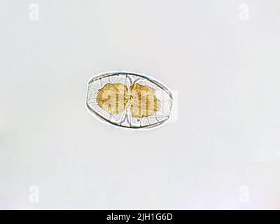 Amphora sp. algae under microscopic view pattern, Diatoms ...