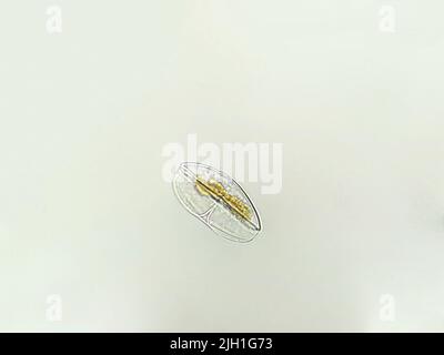 Amphora sp. algae under microscopic view, Diatoms, phytoplankton ...