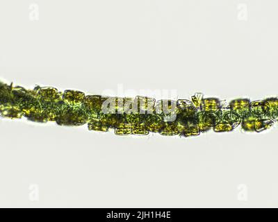Blue-green filamentous algae under microscopic view, cyanobacteria ...