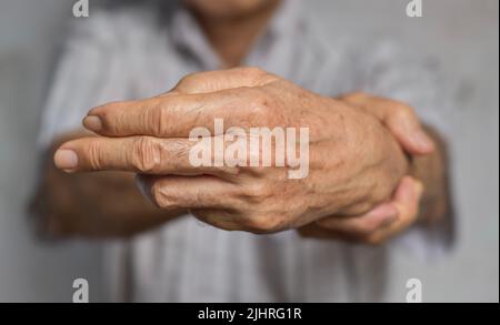 Fingers rigidity, Hand muscles spasm, or Weakness of digits. Closeup ...
