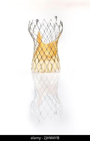 Aortic valve replacement surgery on of human heart final surgical ...