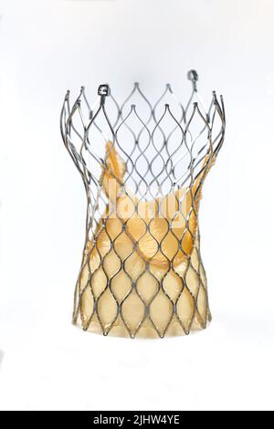 Aortic valve replacement surgery on of human heart final surgical ...