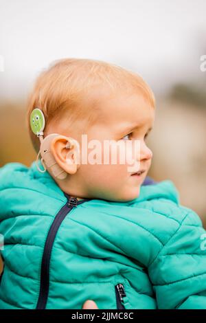 A shot of a baby with cochlear implants Stock Photo - Alamy