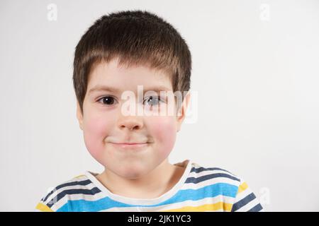 cheeks of child with eczema Stock Photo - Alamy