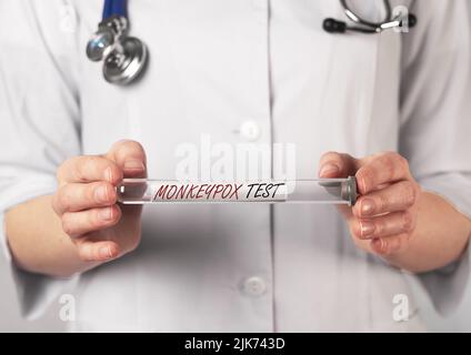 Monkey pox test tube in lab, on white medical desk. Equipment for ...