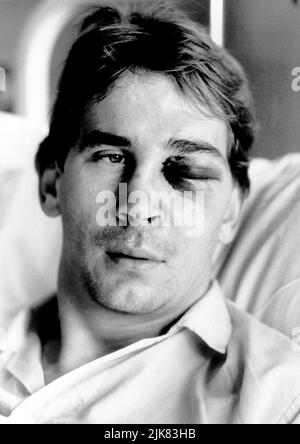 PORTSMOUTH GOALKEEPER ALAN KNIGHT IN HOSPITAL AFTER THE WIMBLEDON MATCH ...