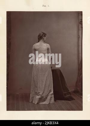 Spinal disease and spinal curvature : their treatment by suspension and ...