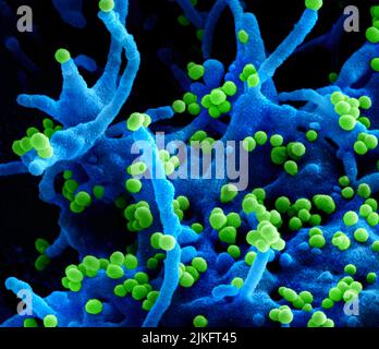 Scanning electron micrograph of Lassa virus budding off a Vero cell ca ...