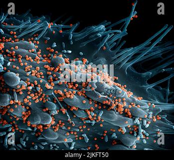 Scanning electron micrograph of Lassa virus budding on a Vero cell ...