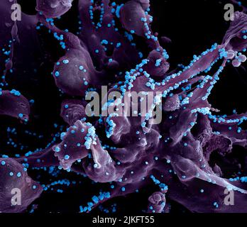 Scanning electron micrograph of Lassa virus budding from a cell. Lassa ...