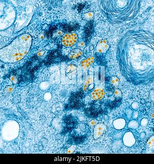 transmission electron microscope image of yellow fever virus Stock ...