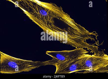 Cell structure. Fluorescent light micrograph of cultured cells from a ...