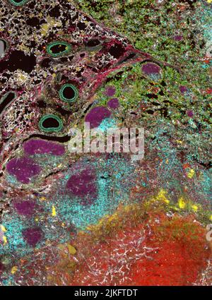 Lymph node, light micrograph Stock Photo - Alamy