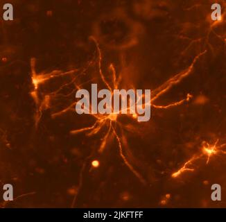 Light micrograph of neuron cell bodies in the substantia nigra of the ...