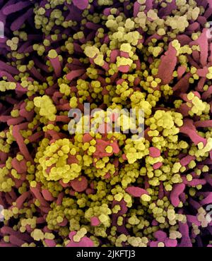 Colorized electron microscope image of yellow fever virus ...