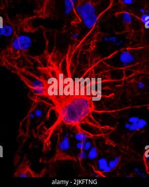 Astrocyte cell in brain tissue, light micrograph. The astrocyte cell ...