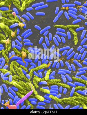 Cholera bacteria (Vibrio cholerae) in human small intestine, computer ...