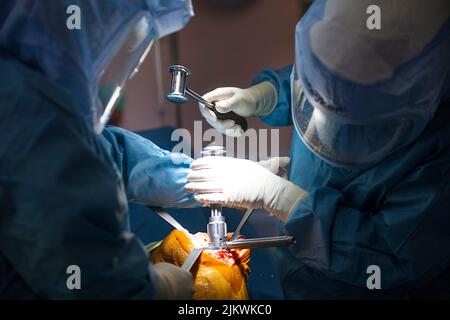 Knee replacement surgery. Orthopaedic surgeon using a hammer during a ...