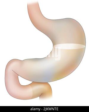 Stomach: the food bolus is represented inside Stock Photo - Alamy