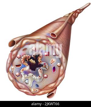 Chronic obstructive pulmonary disease. Artwork of the bronchi of the ...