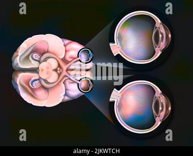Eye: path of the visual pathways from the eye to the visual areas of ...